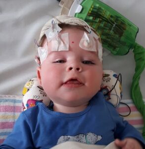 Understanding TSC - Tuberous Sclerosis Australia